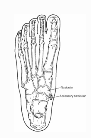 Accessory Navicular Syndrome and Regenerative Medical Therapy ...
